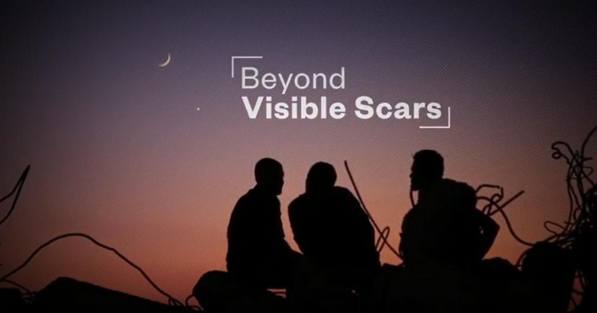 Beyond visible scars: Responding to mental health and psychosocial ...